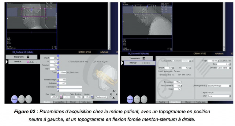 Le manipulateur face au scanner du rocher – Revue de l'INPFP