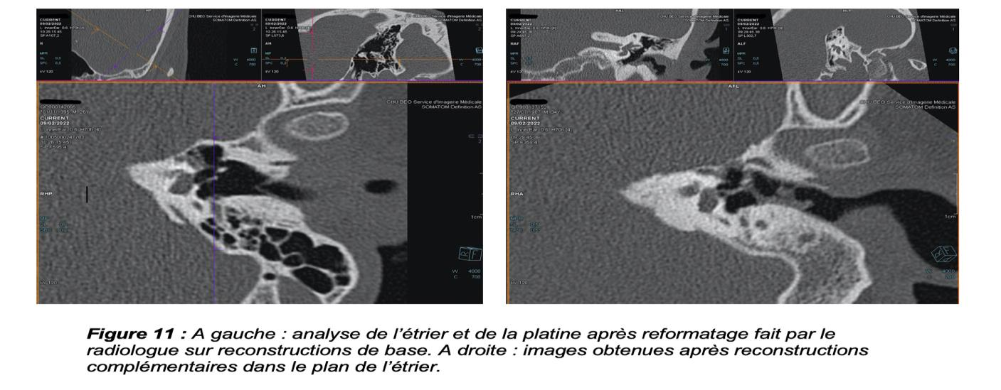 Le manipulateur face au scanner du rocher – Revue de l'INPFP