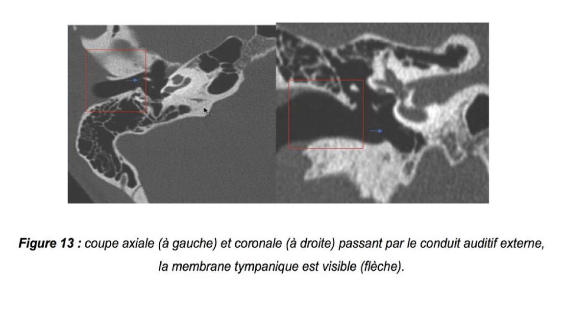 Le manipulateur face au scanner du rocher – Revue de l'INPFP