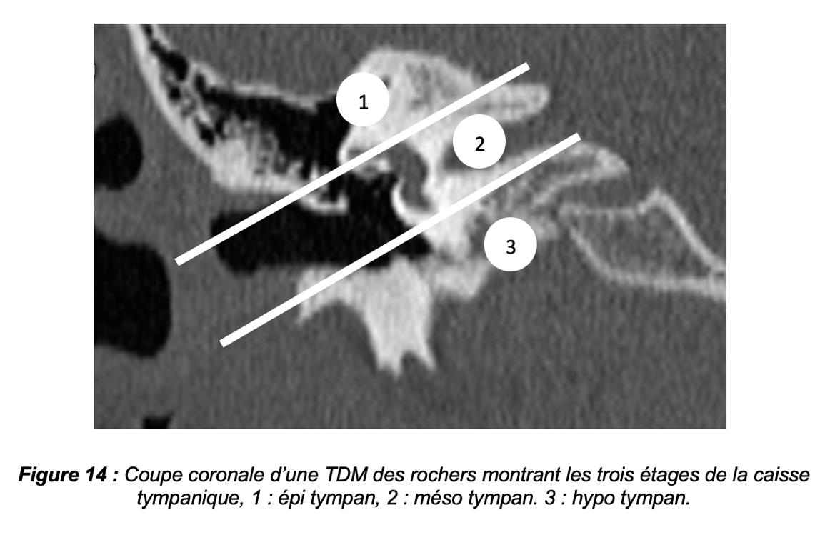 Le manipulateur face au scanner du rocher – Revue de l'INPFP
