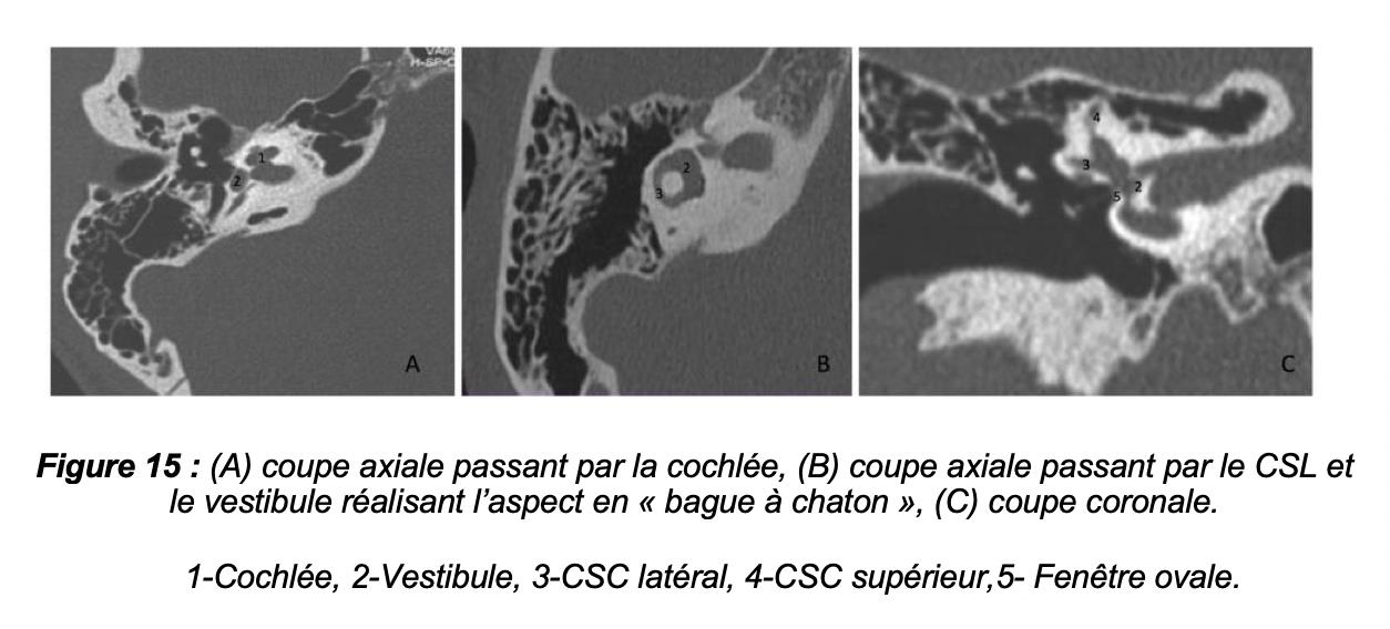 Le manipulateur face au scanner du rocher – Revue de l'INPFP