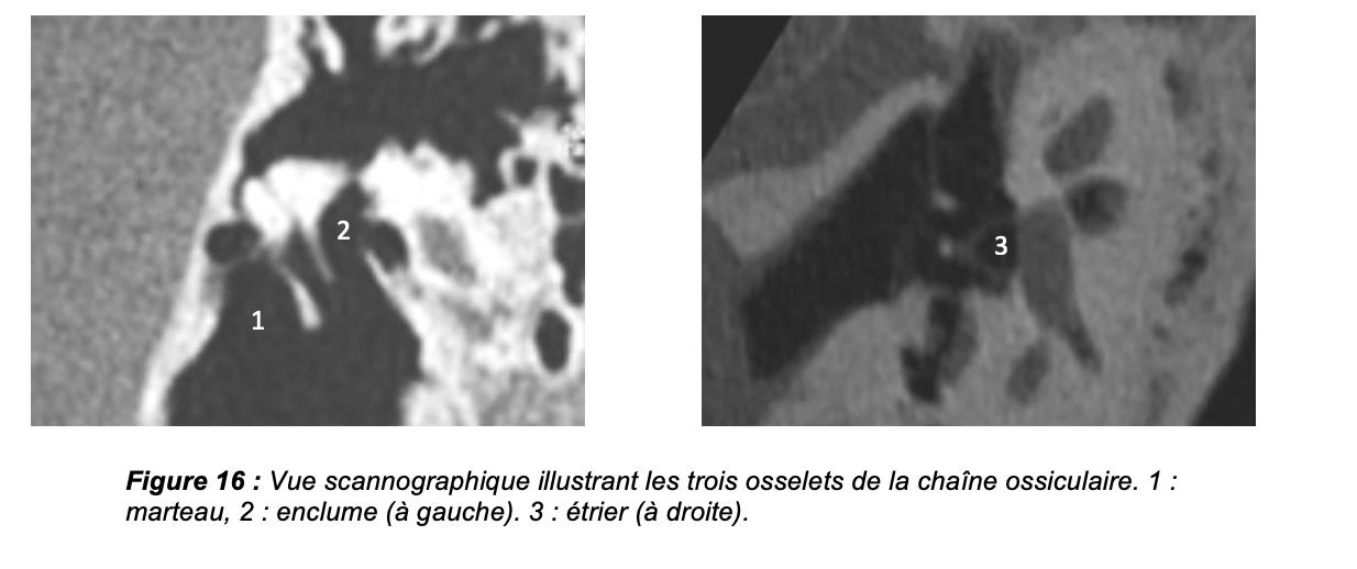 Le manipulateur face au scanner du rocher – Revue de l'INPFP