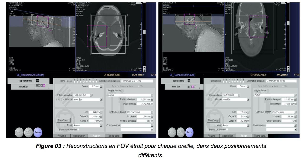 Le manipulateur face au scanner du rocher – Revue de l'INPFP