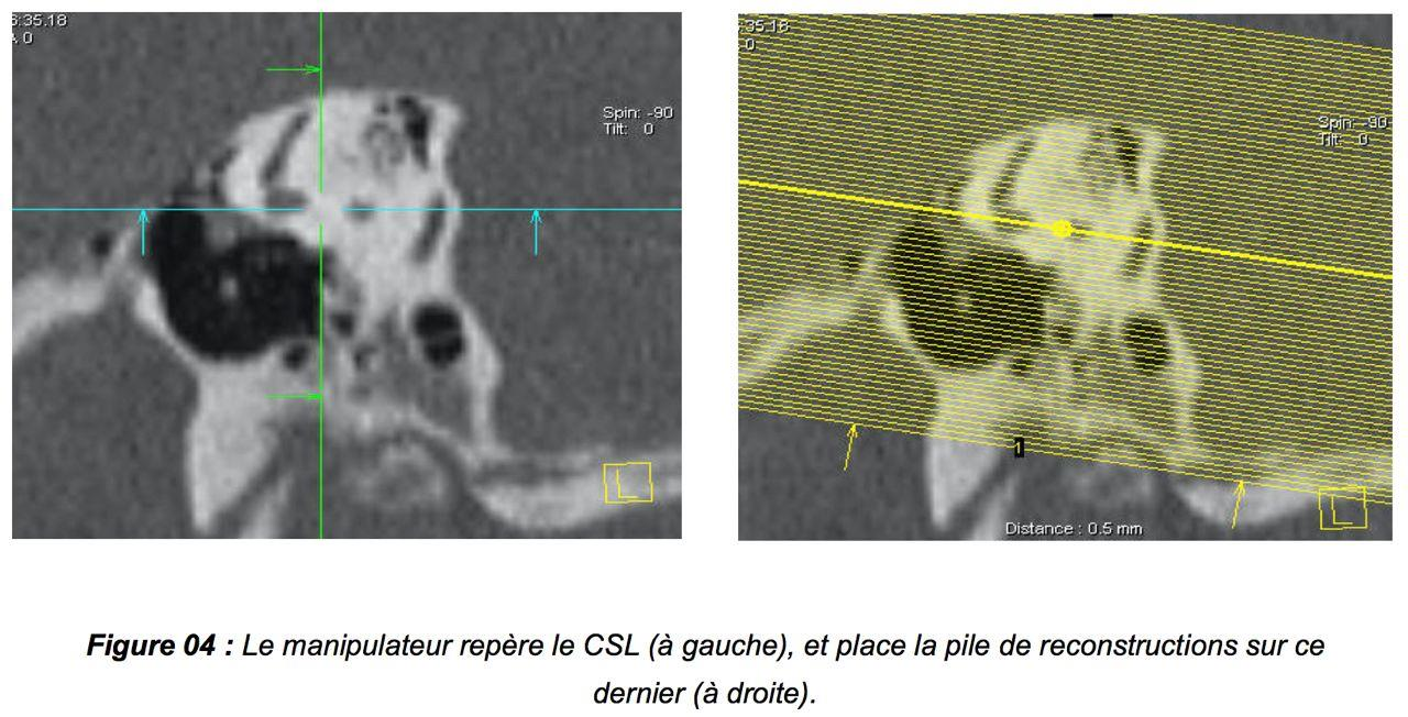 Le manipulateur face au scanner du rocher – Revue de l'INPFP