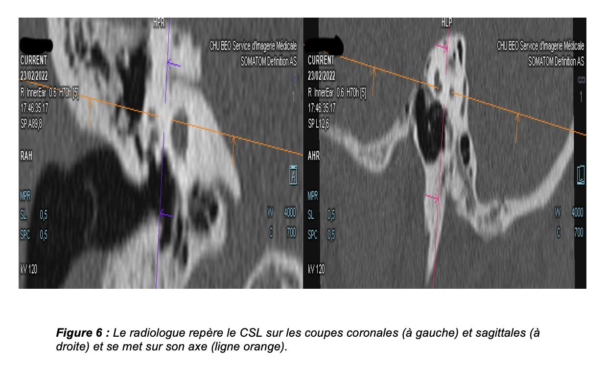Le manipulateur face au scanner du rocher – Revue de l'INPFP