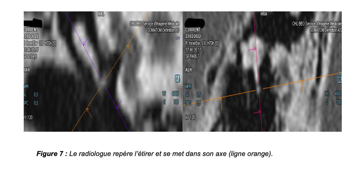 Le manipulateur face au scanner du rocher – Revue de l'INPFP