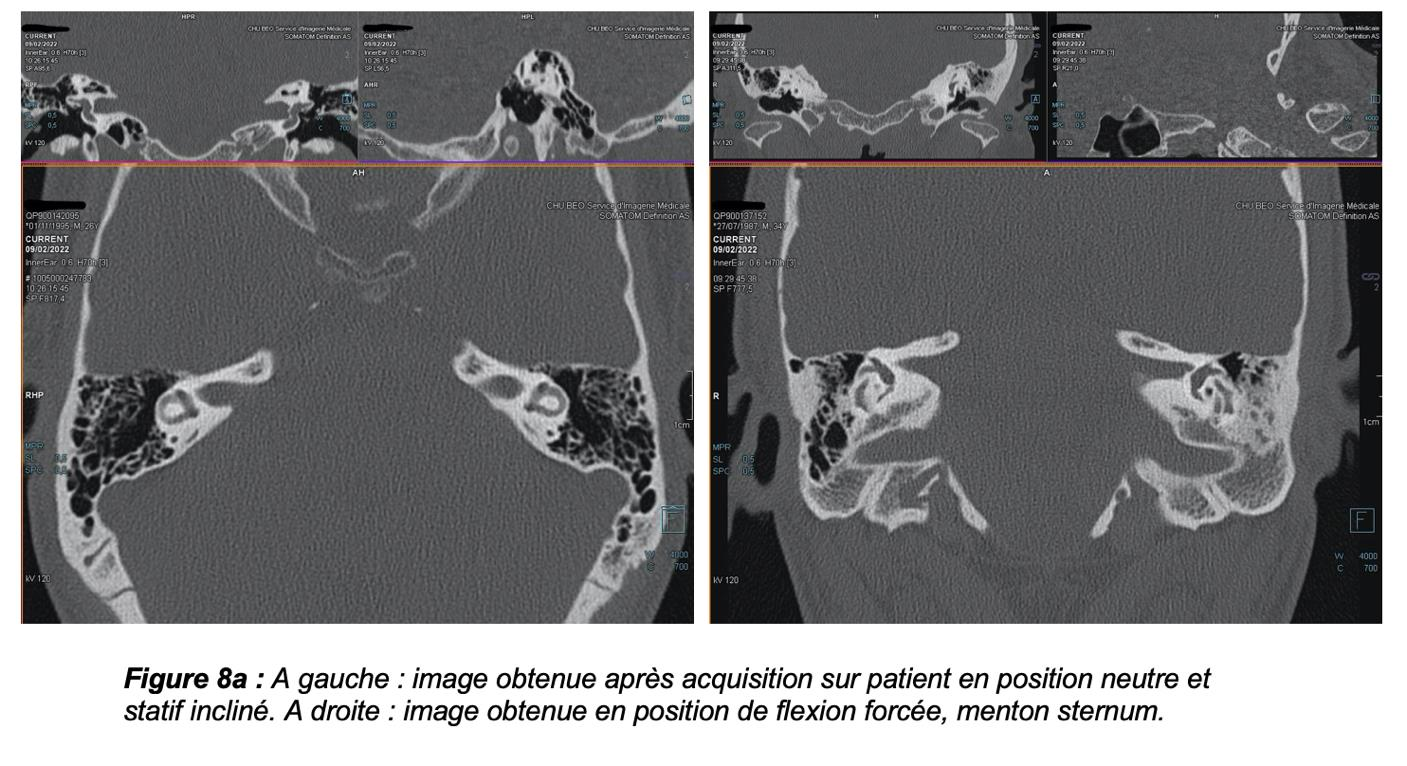 Le manipulateur face au scanner du rocher – Revue de l'INPFP