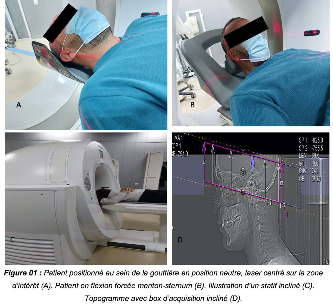 Le manipulateur face au scanner du rocher – Revue de l'INPFP